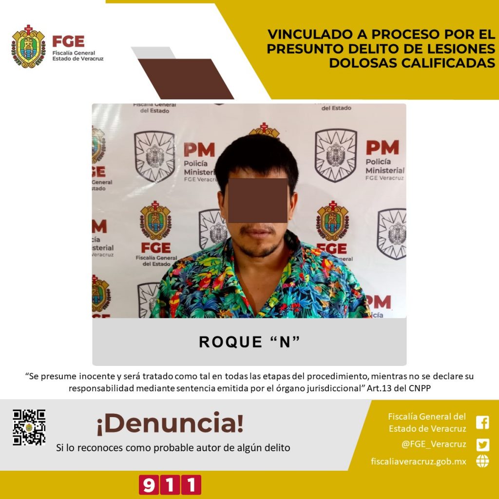 Vinculado A Proceso Por El Presunto Delito De Lesiones Dolosas